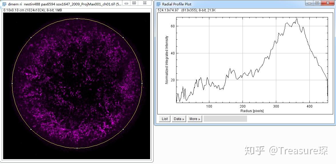 ImageJ实用技巧——径向荧光平均值检测(定量分析篇) - 知乎