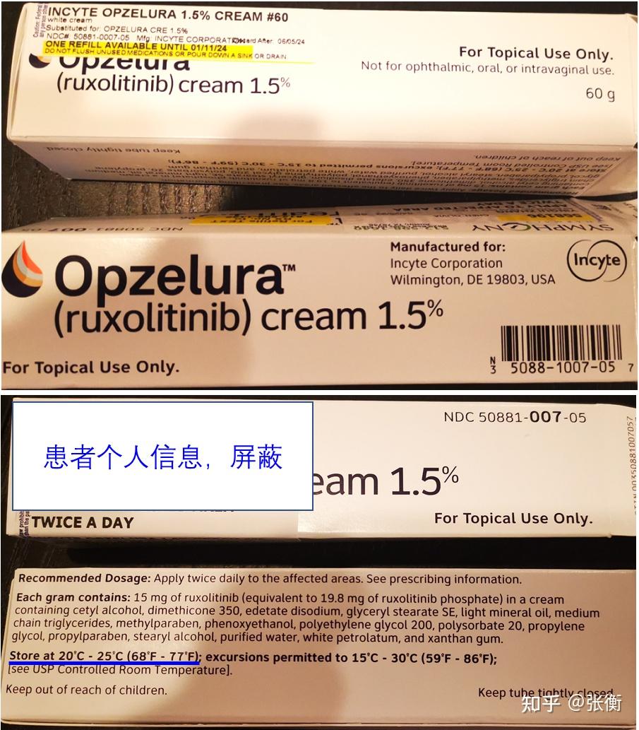 【患者角度】Opzelura 芦可替尼乳膏 1.5% 治疗白癜风 - 知乎