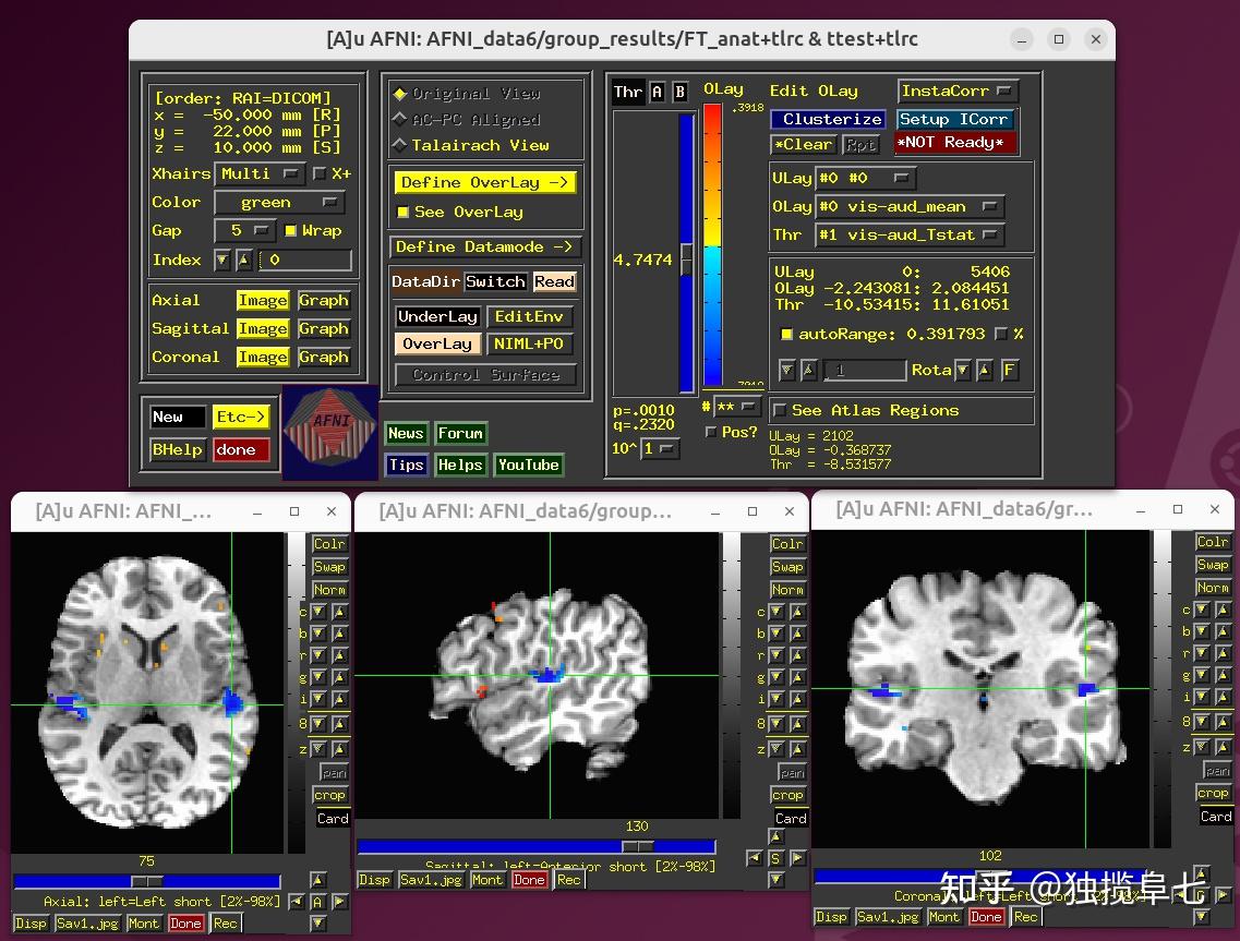 用AFNI处理fMRI数据 - 知乎