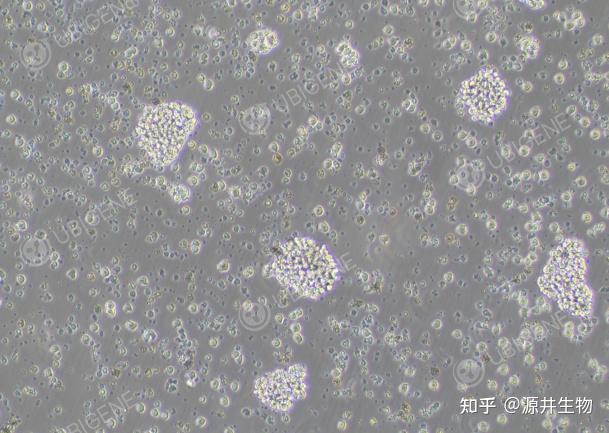 干货|Jurkat细胞培养与基因编辑Tips来啦！ - 知乎