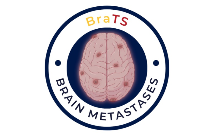 BraTS2023-MET 数据集介绍 - 知乎