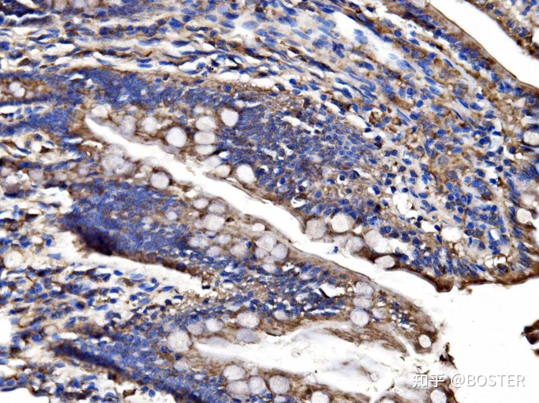 细胞器标记物蛋白的免疫组化/荧光 - 知乎