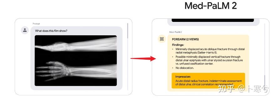 最强语言模型 PaLM2 亮相，Bard 能力跃升，它可以实现哪些功能？算是 ChatGPT 杀手吗？ - 知乎
