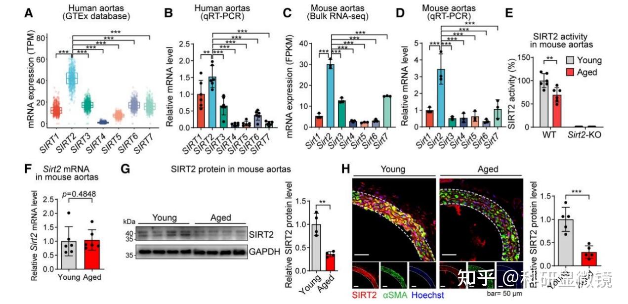 SIRT2如何破解血管衰老之谜？这篇39分文章指引你的科研设计之路 - 知乎