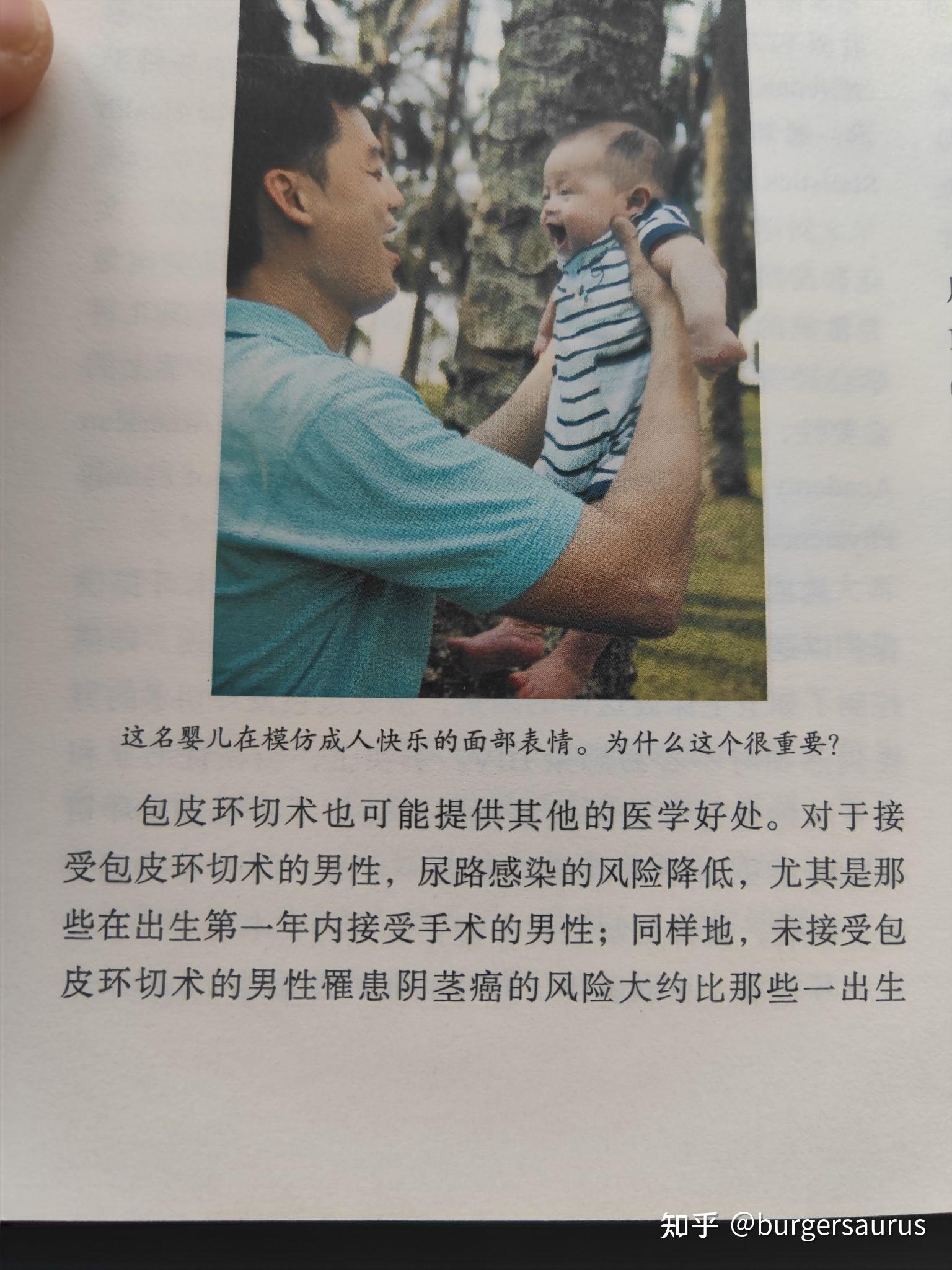 孩子几岁开始做包皮手术合适? 知乎