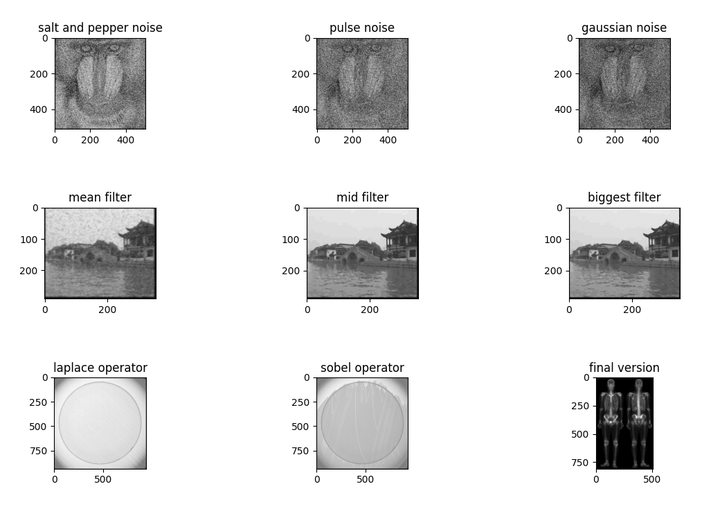 【数字图像处理3】不使用openCV，完成图像的增加噪声、去除噪声（基于滤波器），以及基于Laplace/Sobel算子的边缘检测 - 知乎