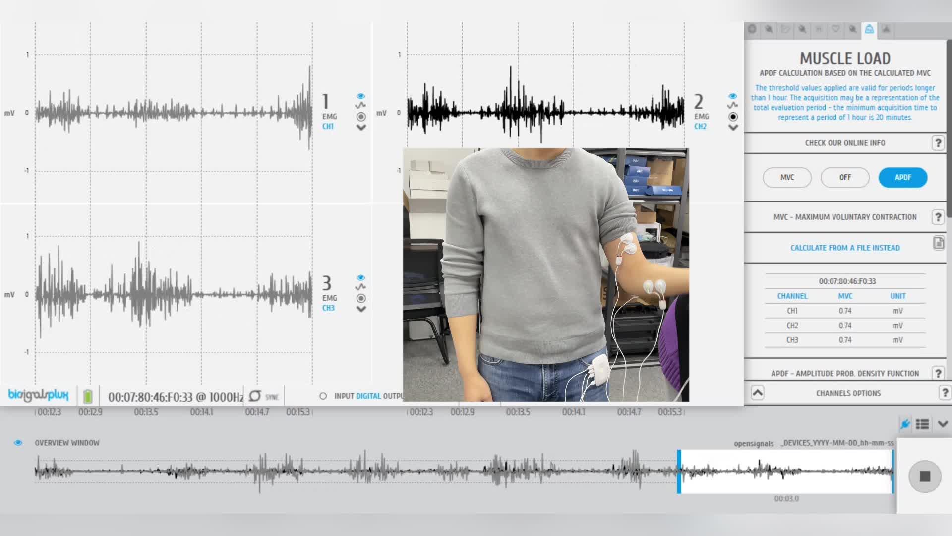 EMG肌电信号测量与常用分析方法 - 知乎