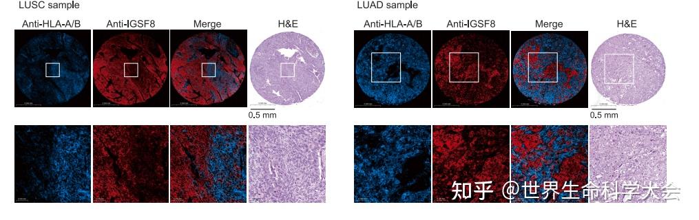 Cell | IGSF8——全新癌症治疗靶点的发现 - 知乎