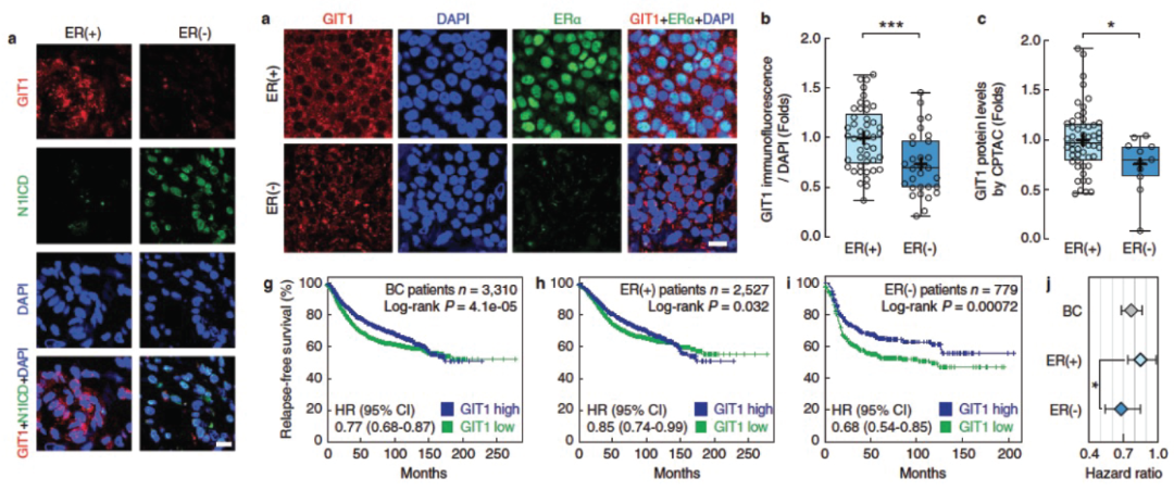 Nat Commun︱卡罗林斯卡医学院发现GIT1抑制乳腺癌生长并可评估患者预后风险 - 知乎