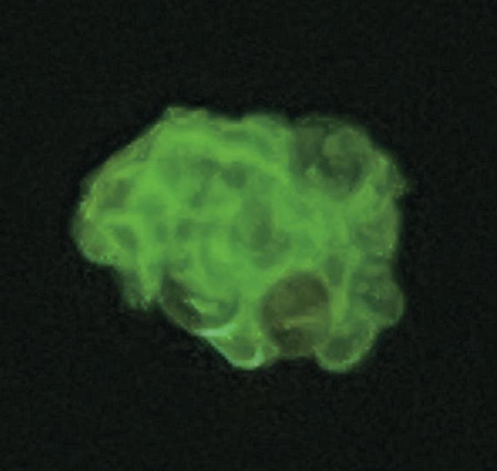 Nejm 2021 Case 35 - 知乎