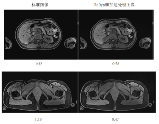 医学成像领域的奠基者系列——Dimitris Metaxas与分析心脏MRI图像的算法 - 知乎