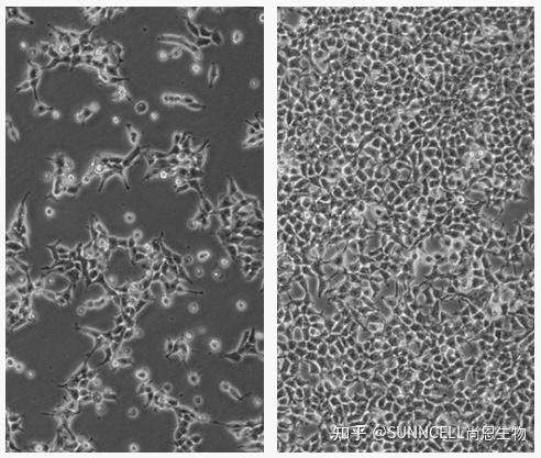 293T细胞怎么培养? - 知乎