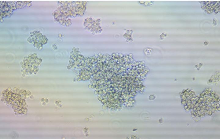 SHP-77 人小细胞肺泡细胞 - 知乎