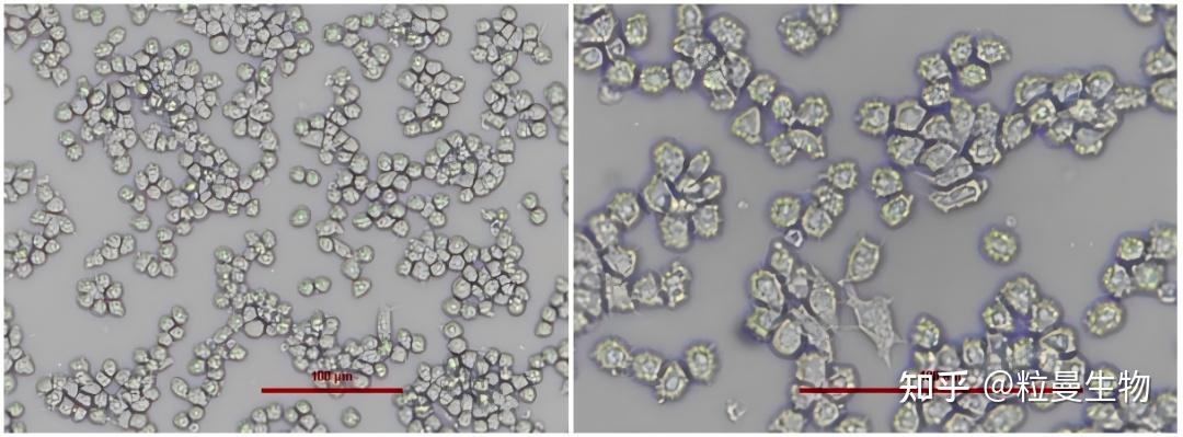 一叶知秋 | RAW264.7基因敲除细胞：解锁巨噬细胞研究的“黄金工具” - 知乎