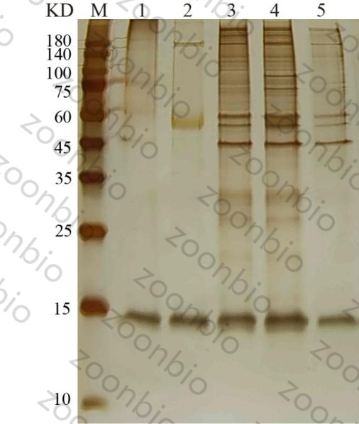 DNA Pull down实验常见问题 - 知乎