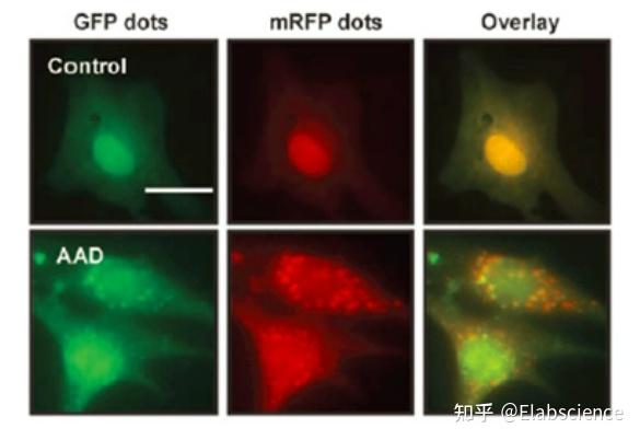 细胞自噬是什么？如何检测？ - 知乎