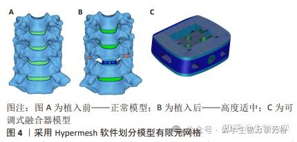 新型高度可调颈椎融合器的三维有限元分析 - 知乎