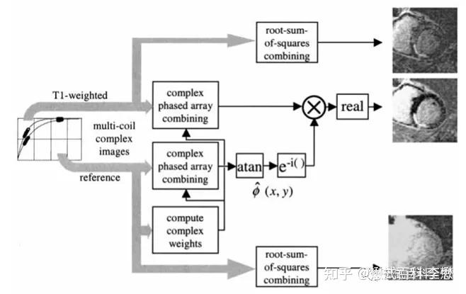 PSIR序列原理及临床应用 - 知乎
