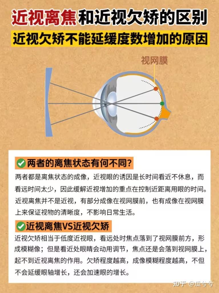 调节功能检查NRA和PRA - 知乎