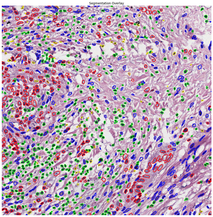 HoVer-Net复现：手把手带你实现细胞核的分割与分类，并输出叠加图像 - 知乎