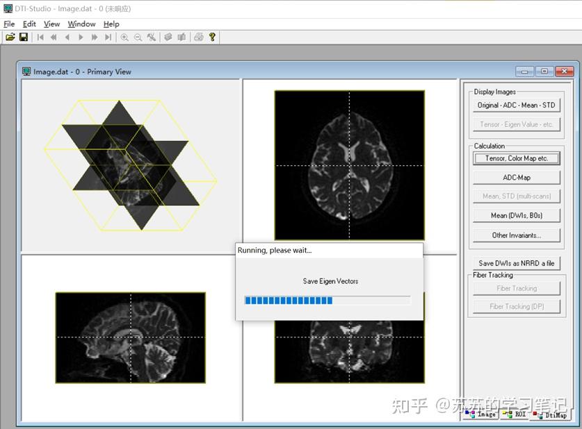 DTI Studio操作教程 - 知乎
