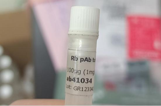 Abcam品牌Anti-PSMA antibody（兔来源）的售后服务流程 - 知乎