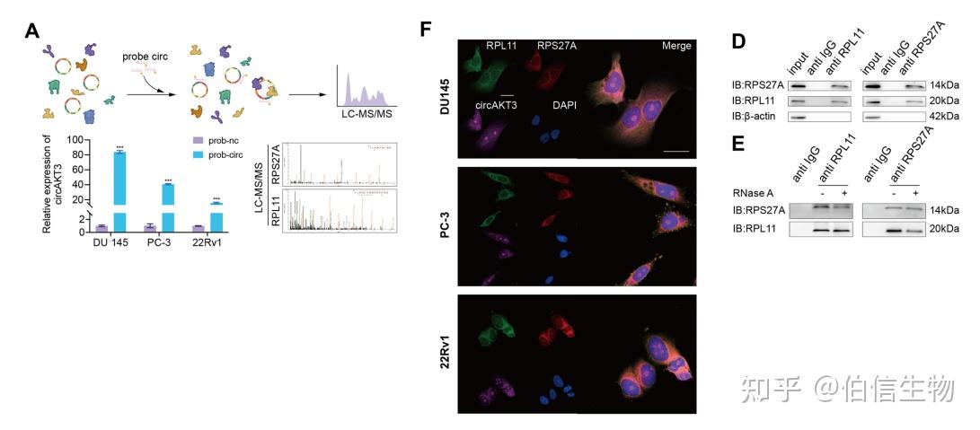 CircAKT3通过增强RPS27A和RPL11的结合来促进前列腺癌的增殖和转移 - 知乎