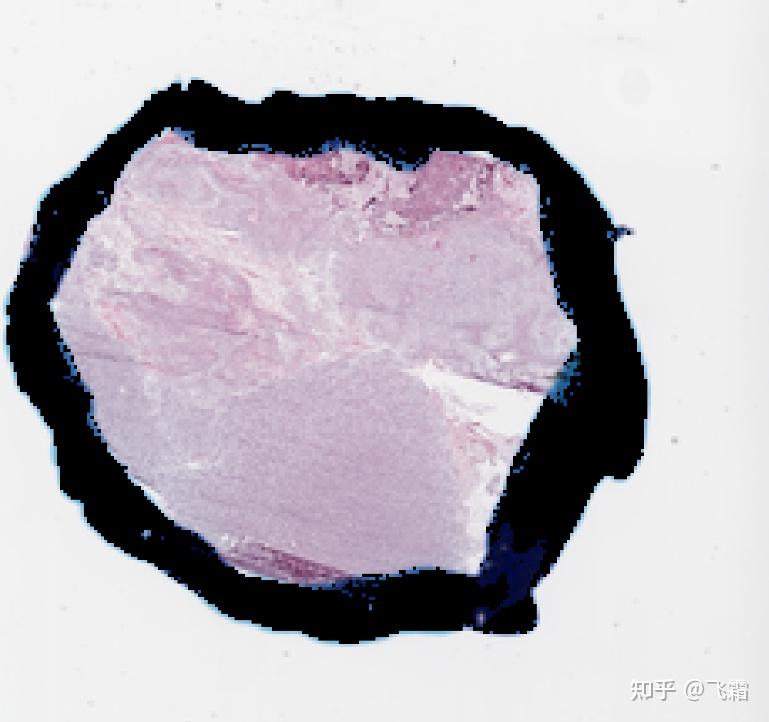 医学图像实战：病理学WSI图像的预处理 - 知乎