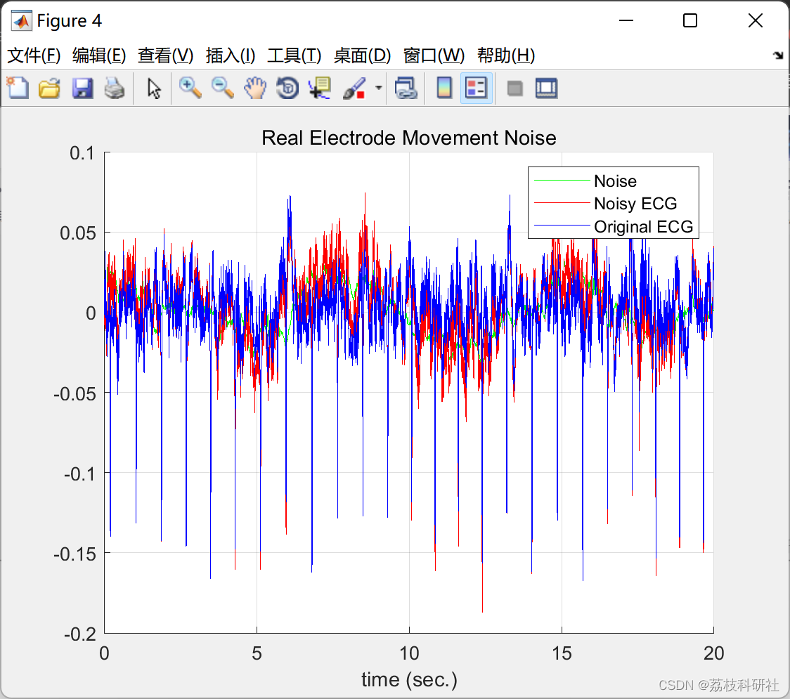 ECG信号处理——包括基本波检测、信号去噪、信号重建度量（Matlab代码实现） - 知乎