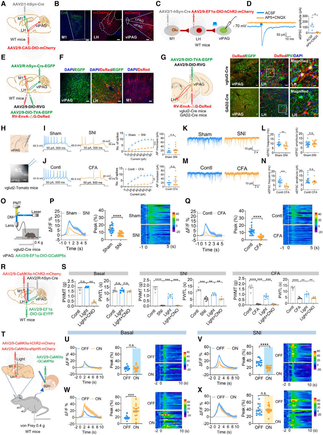 【客户文章】新发现！“痛则不动，动则不痛”—空医大罗层/武胜昔教授团队揭示靶向初级运动皮层改善慢性疼痛的感觉-运动互作新机制 - 知乎