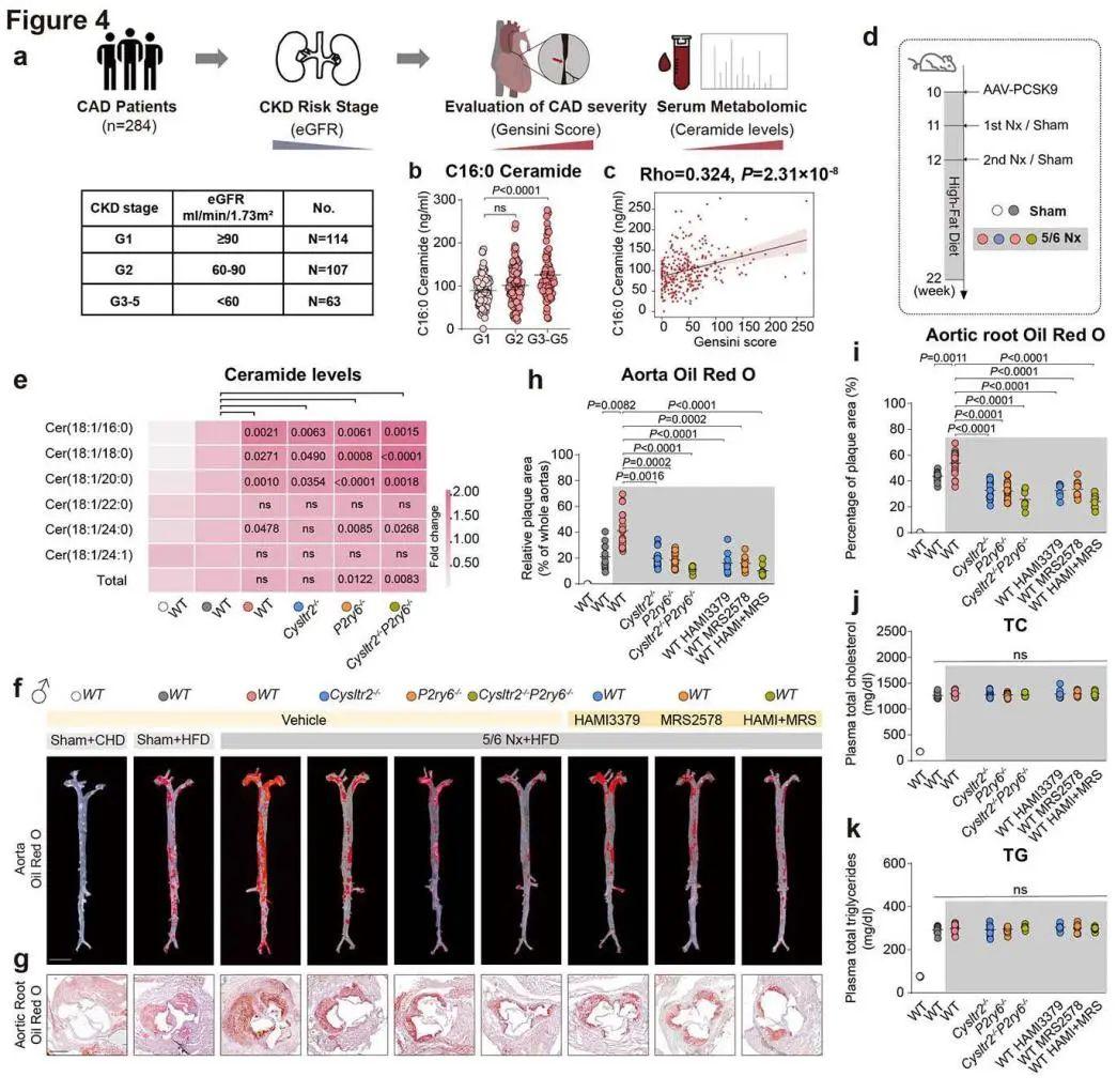 Nature丨发现动脉粥样硬化全新治疗靶点，神经酰胺受体结构首揭 - 知乎