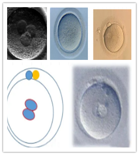 胚胎受精（有效区分0PN，1PN，2PN，3PN/4PN） - 知乎