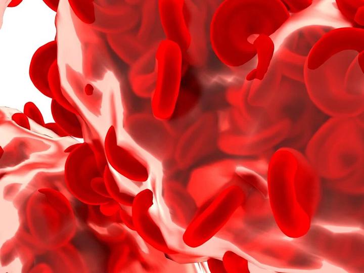 首个冷凝集素病药物！欧盟批准赛诺菲Enjaymo (sutimlimab)上市 - 知乎