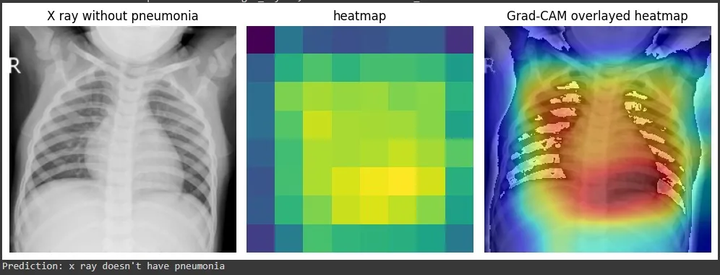 Grad-CAM的详细介绍Pytorch代码实现 - 知乎