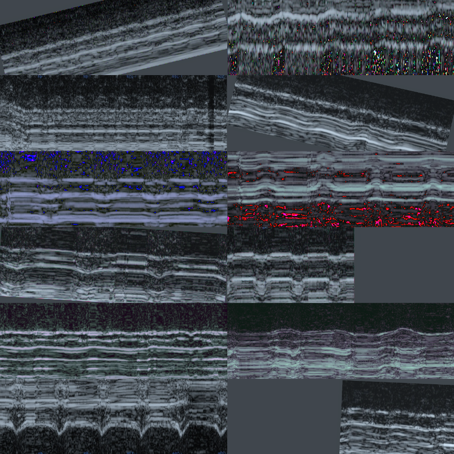 nnUnet v2项目学习记录，训练自定义模型（不是Unet） - 知乎