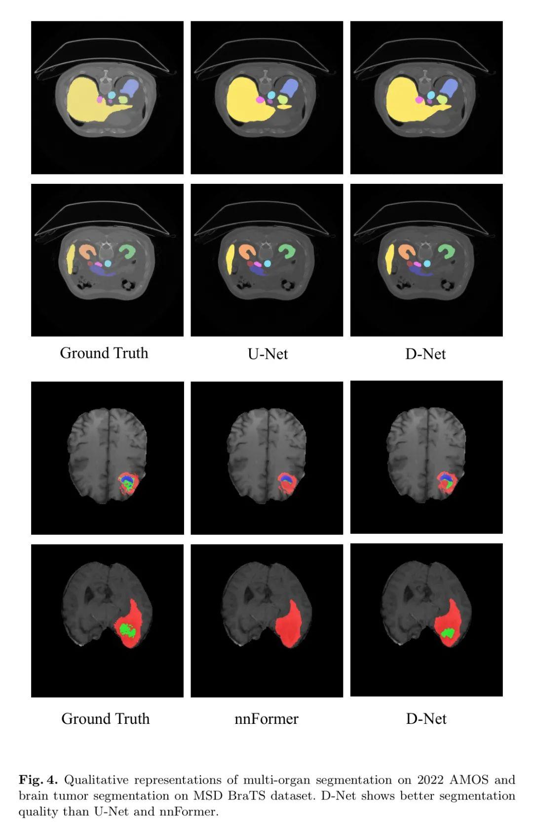 复旦大学提出D-Net：Transformer中融合动态大卷积核&动态特征融合模块，让分割效果骤升 - 知乎