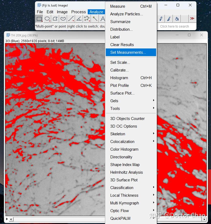 组化片子如何利用Image J 进行阳性信号面积占比统计分析 - 知乎