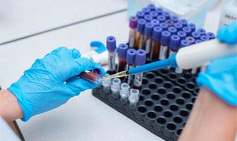 懂了这些知识，能帮你做好Th1/Th2检测 - 知乎