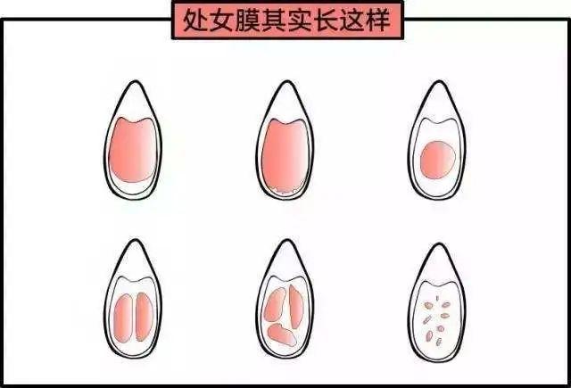如何判断女生处女膜还在不在? 知乎