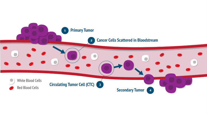前沿 | CTC建功？结肠癌血液筛查现出曙光，CellMax Life的前瞻性筛查数据出色，FDA申报进程稳步推进中 - 知乎