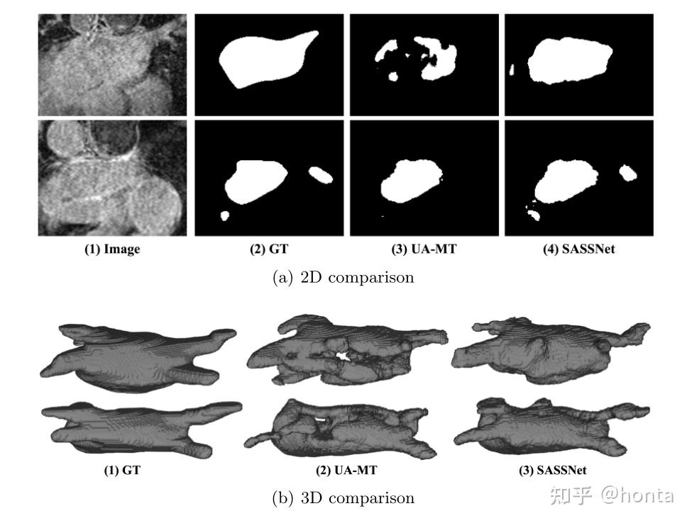 学习笔记：SASSNet: Shape-aware Semi-supervised 3D Semantic Segmentation for ...