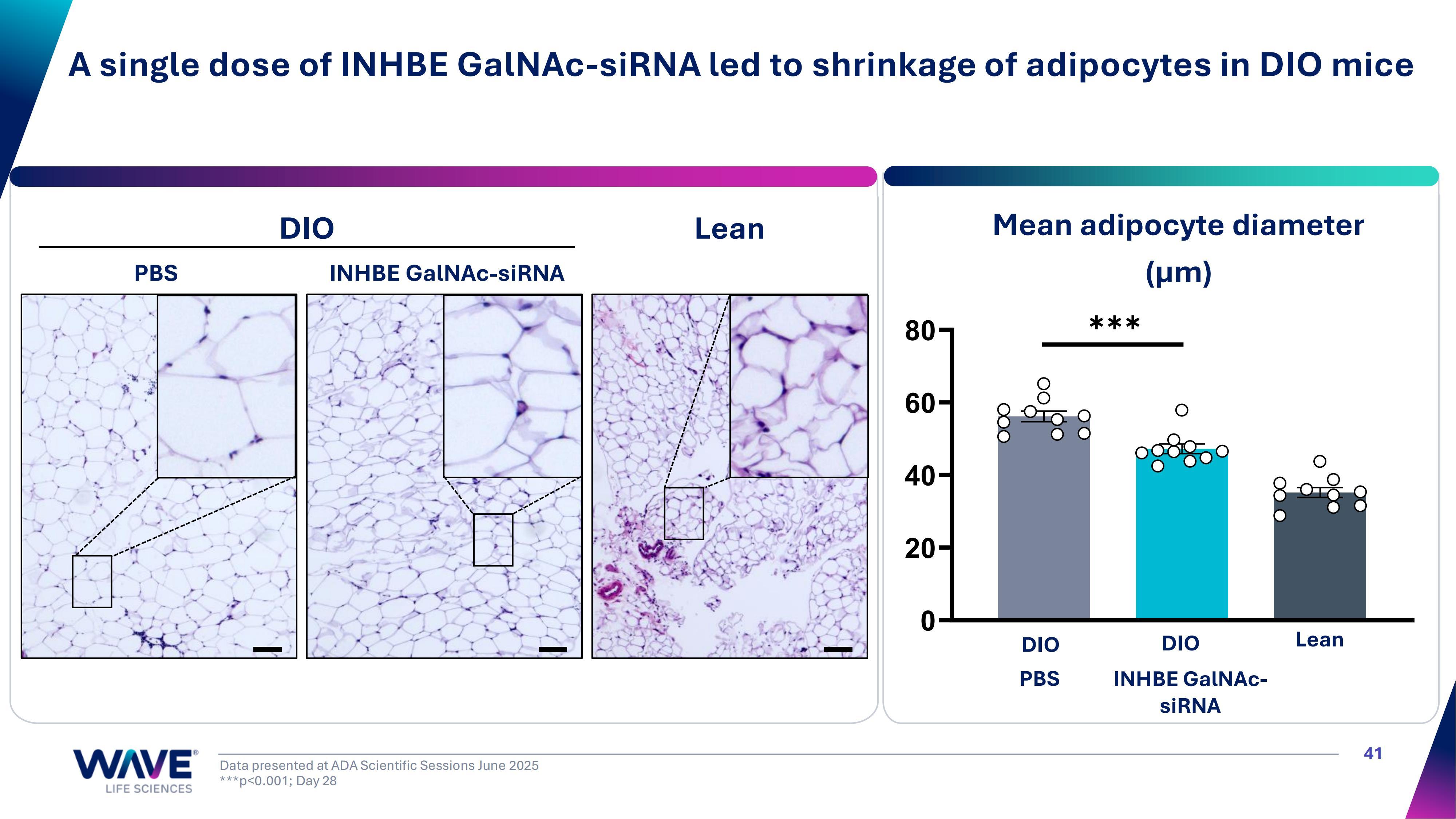 打破 INHBE siRNA 研发静默，WAVE 首次公开临床研究数据 - 知乎