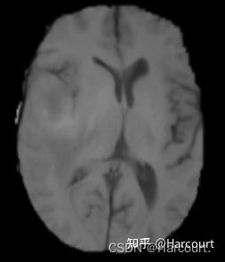 论文阅读笔记——M3AE:缺失模态下脑肿瘤分割的多模态表征学习 - 知乎