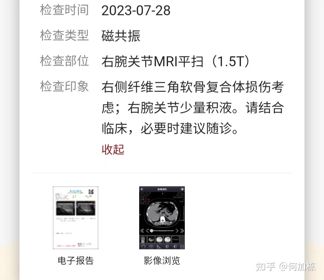 TFCC后，我是如何进行健身训练的 - 知乎