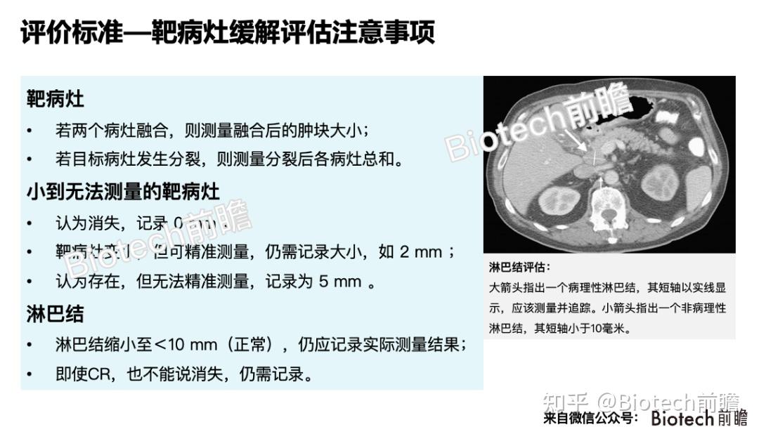 试验设计课堂丨读懂实体瘤疗效（RECIST1.1、mRECIST等）评估 - 知乎