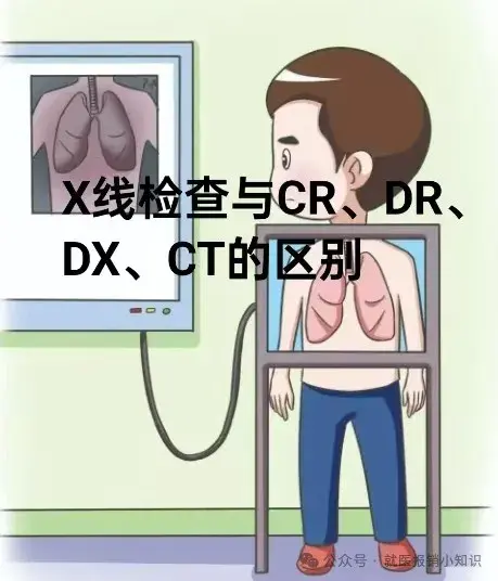 X线检查与CR、DR、DX、CT的区别 - 知乎