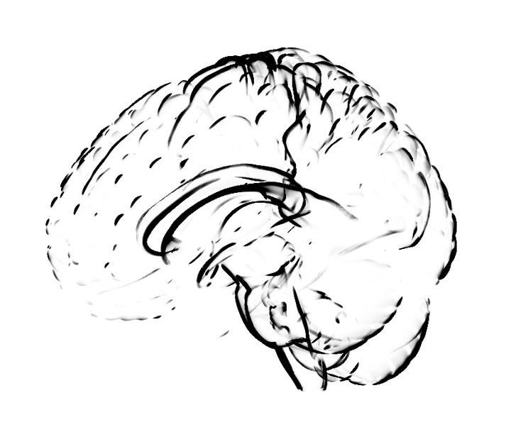 NIfTI和DICOM的格式互相转换 - 知乎