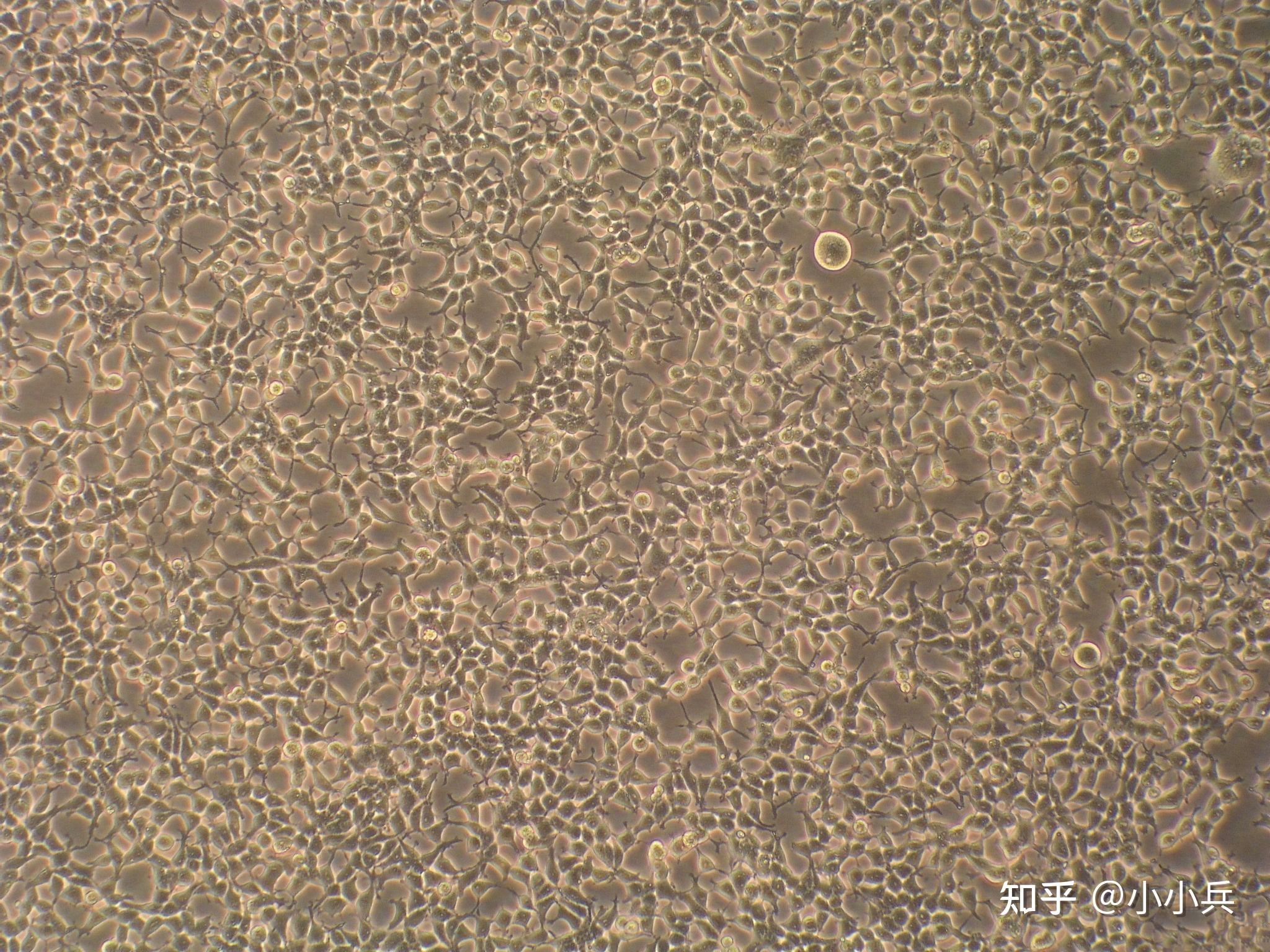 hek293t细胞? - 知乎
