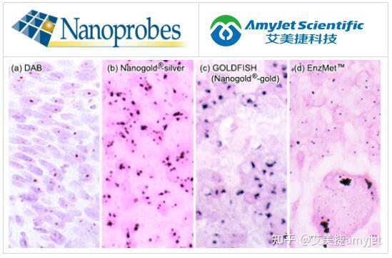 Nanoprobes原位杂交：基因检测的演变（从 Nanogold到EnzMet） - 知乎