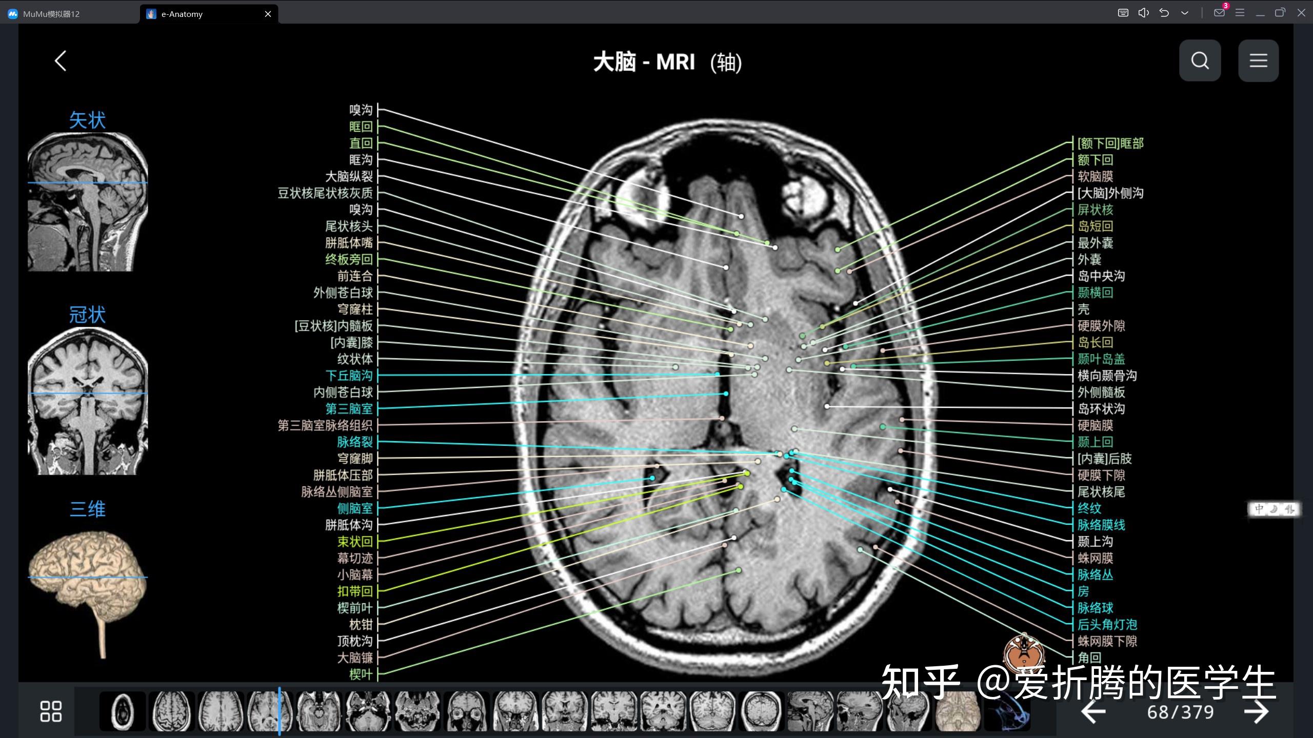 最新中文版e-anatomy解锁版 - 知乎